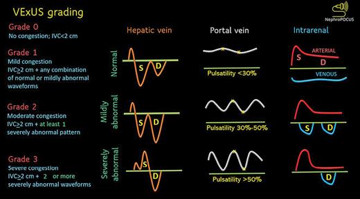 Diagnosis of Fluid Overload: From Conventional to Contemporary Concepts ...