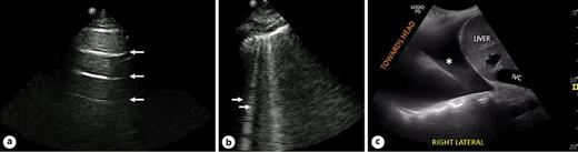 Diagnosis of Fluid Overload: From Conventional to Contemporary Concepts ...