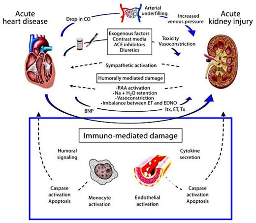 Cardiorenal Syndrome Type 1 May Be Immunologically Mediated: A Pilot ...