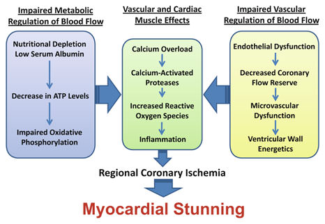Myocardial Stunning with Hemodialysis: Clinical Challenges of the ...