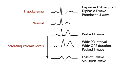 Chronic Hyperkalemia in Cardiorenal Patients: Risk Factors, Diagnosis ...