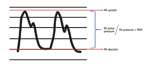 Echocardiographic and Hemodynamic Parameters Associated with ...