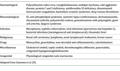 Sneddon Syndrome: A Case Report Exploring the Current Challenges Faced ...