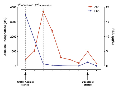 The Alkaline Phosphatase Flare Phenomenon: A Transient Substantial ...
