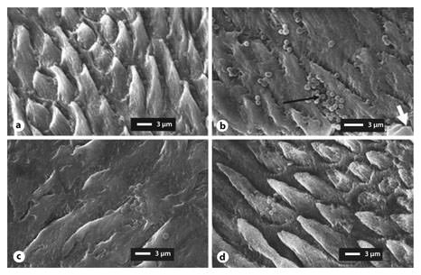 The Structure and Composition of Deciduous Enamel Affected by Local ...