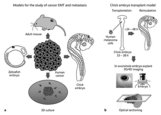 The Neural Crest and Cancer: A Developmental Spin on Melanoma | Cells ...