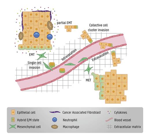 Epithelial-Mesenchymal Transition (EMT) as a Therapeutic Target | Cells ...