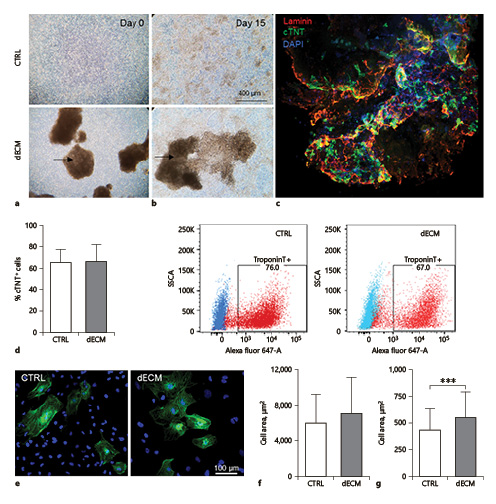 Decellularized Extracellular Matrix Powder Accelerates Metabolic ...