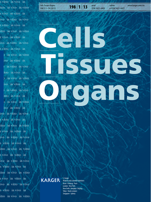 The Neural Crest and Cancer: A Developmental Spin on Melanoma | Cells ...