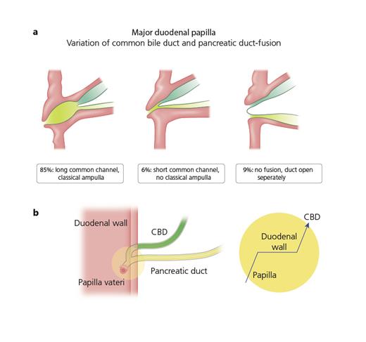 Biliary Cannulation in Endoscopic Retrograde Cholangiography: How to ...