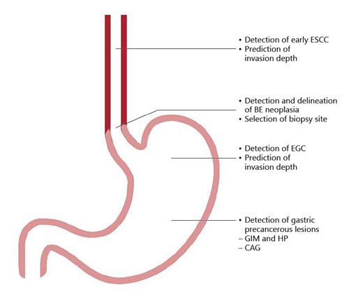 Artificial Intelligence in Upper Gastrointestinal Endoscopy | Digestive ...