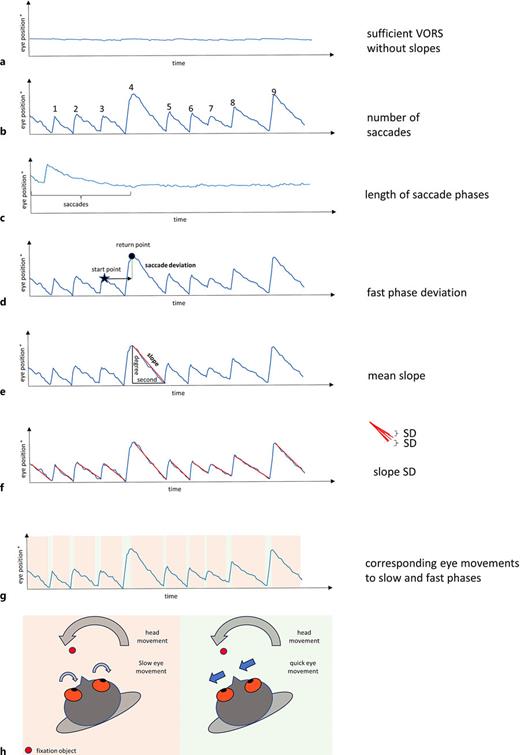 Vestibulo-Ocular Reflex Suppression: Clinical Relevance and Assessment ...