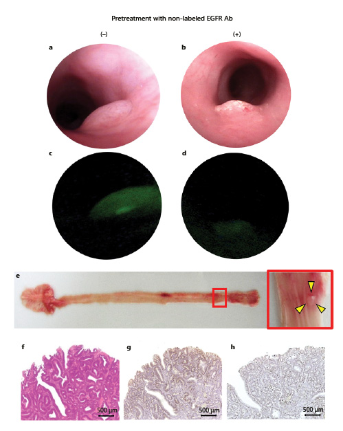 Recent Advances in Molecular Imaging of Colorectal Tumors | Digestion ...