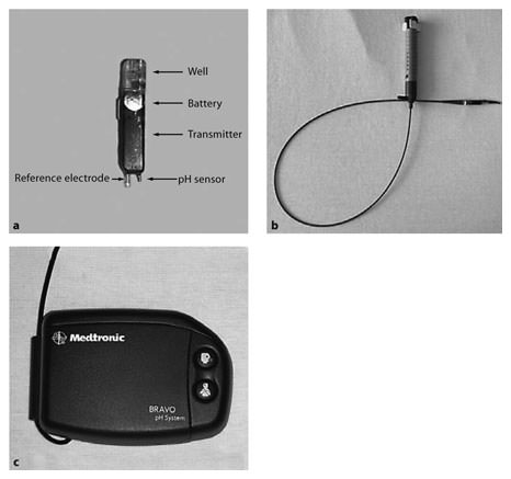 Wireless Capsule pH Monitoring: Does It Fulfil All Expectations ...