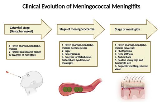 Up-to-Date Review of Meningococcal Meningitis: Global Challenges and ...