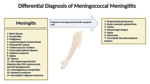 Up-to-Date Review of Meningococcal Meningitis: Global Challenges and ...