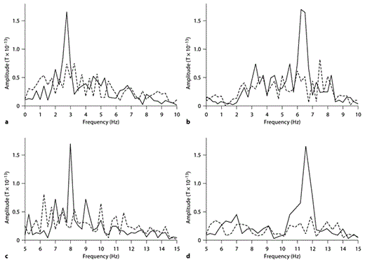 Development of Mu Rhythm in Infants and Preschool Children ...