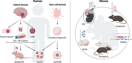 Pediatric Glioma Models Provide Insights into Tumor Development and ...