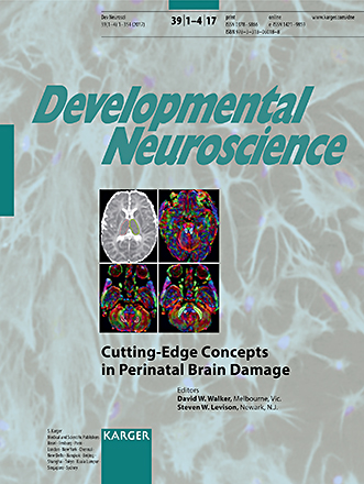 Proteomic Analysis of Mouse Cortex Postsynaptic Density following ...