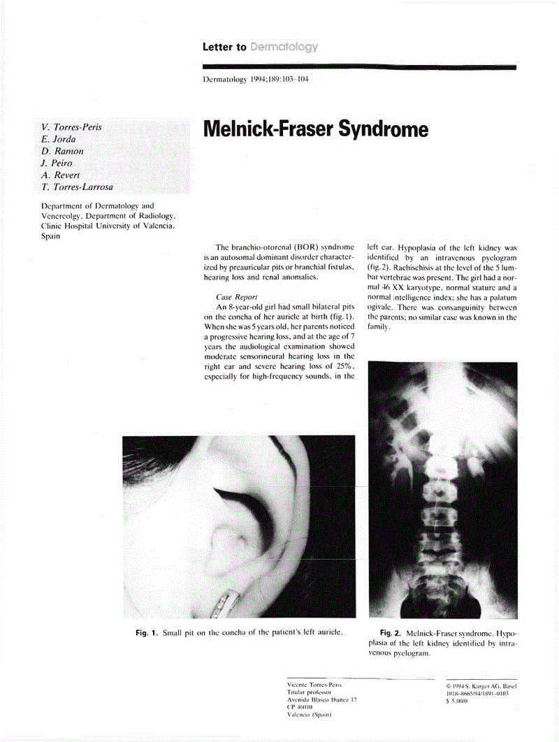 Melnick-Fraser Syndrome | Dermatology | Karger Publishers