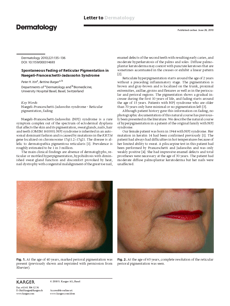Spontaneous Fading of Reticular Pigmentation in Naegeli-Franceschetti ...