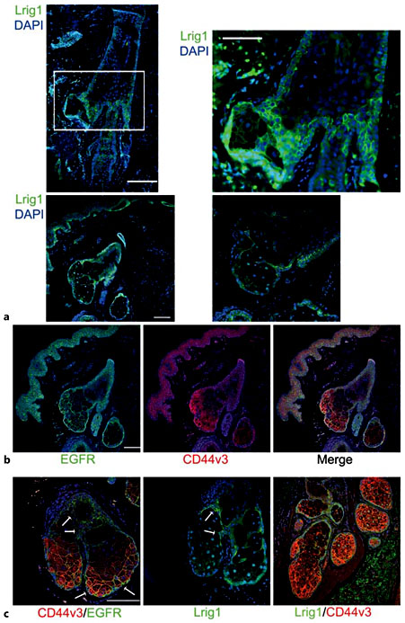 Lrig1 and CD44v3 Expression in the Human Folliculosebaceous Unit ...