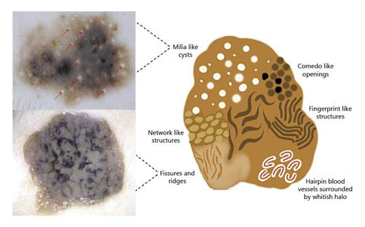 Advances in the Etiology, Detection, and Clinical Management of ...