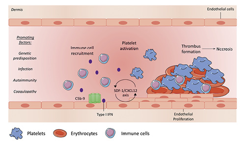 Atrophic Papulosis | Dermatology | Karger Publishers