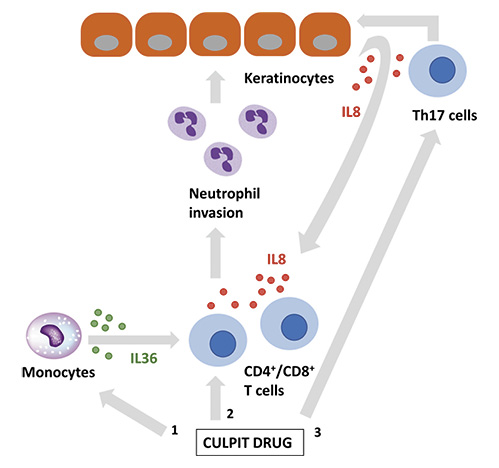 Acute Generalized Exanthematous Pustulosis: Clinical Characteristics ...