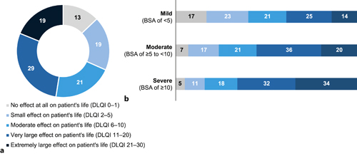 Patient Perspectives on Psoriatic Disease Burden: Results from the ...