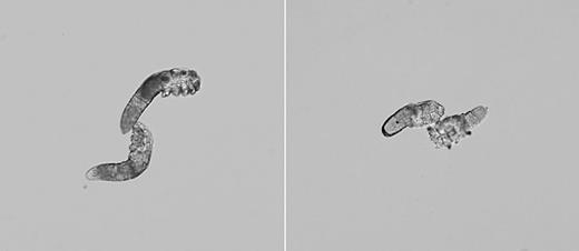 Evidence for the Clinical Association between Demodex and Rosacea: A ...