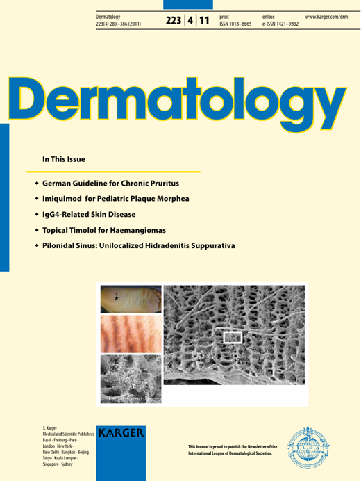 Efficacious Treatment of Non-Dermatophyte Mould Onychomycosis with ...