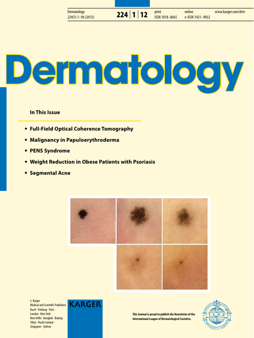 Indication for Random Skin Biopsy for the Diagnosis of Intravascular ...