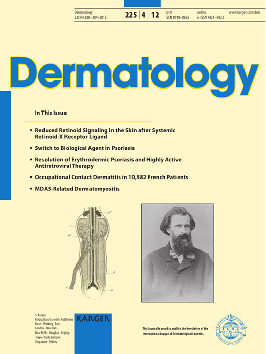 Febrile Ulceronecrotic Mucha-Habermann Disease: Treatment with ...