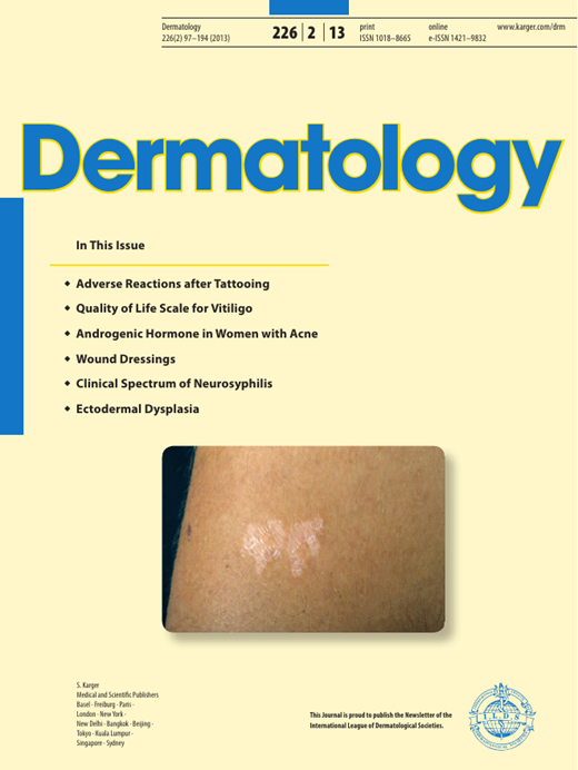 Dermoscopy of Desmoplastic Trichoepithelioma Reveals Other Criteria to ...