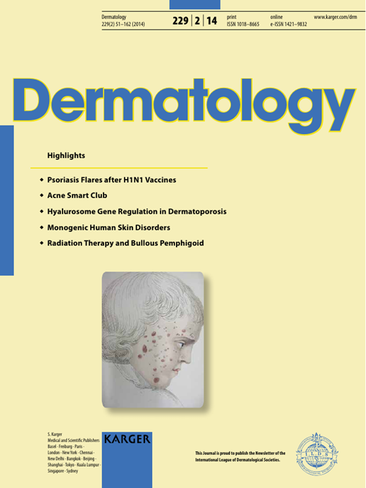 Treatment of Sporotrichoid Fish Tank Granuloma with Pulsed ...