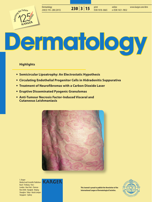 Eruptive Disseminated Pyogenic Granulomas following Lightning Injury ...