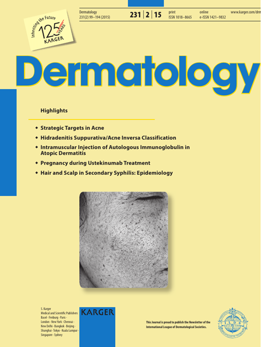 Hidradenitis Suppurativa/Acne Inversa: Criteria for Diagnosis, Severity ...