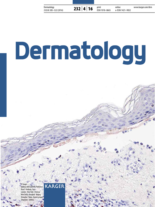 Swiss S1 Guidelines on the Systemic Treatment of Psoriasis Vulgaris ...