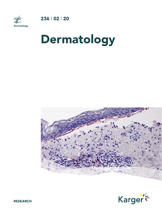 Poikilodermatous Mycosis Fungoides: Comparative Study of Clinical ...