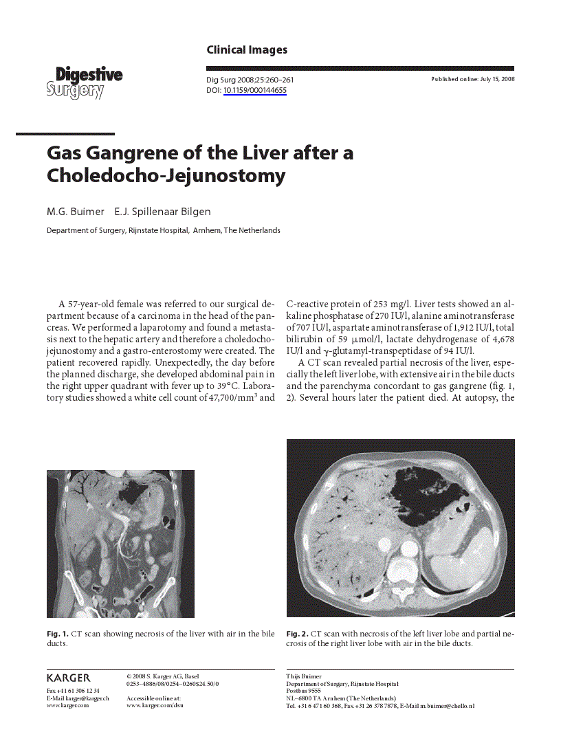 Gas Gangrene of the Liver after a Choledocho-Jejunostomy | Digestive ...