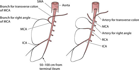 Reappraisal of the Vascular Anatomy of the Colon and Consequences for ...