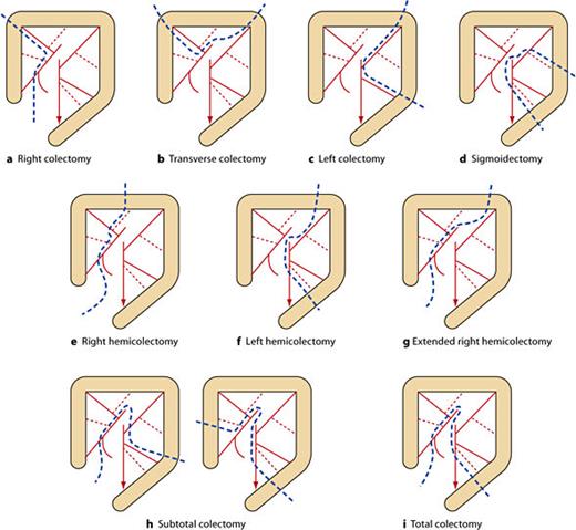 Reappraisal of the Vascular Anatomy of the Colon and Consequences for ...