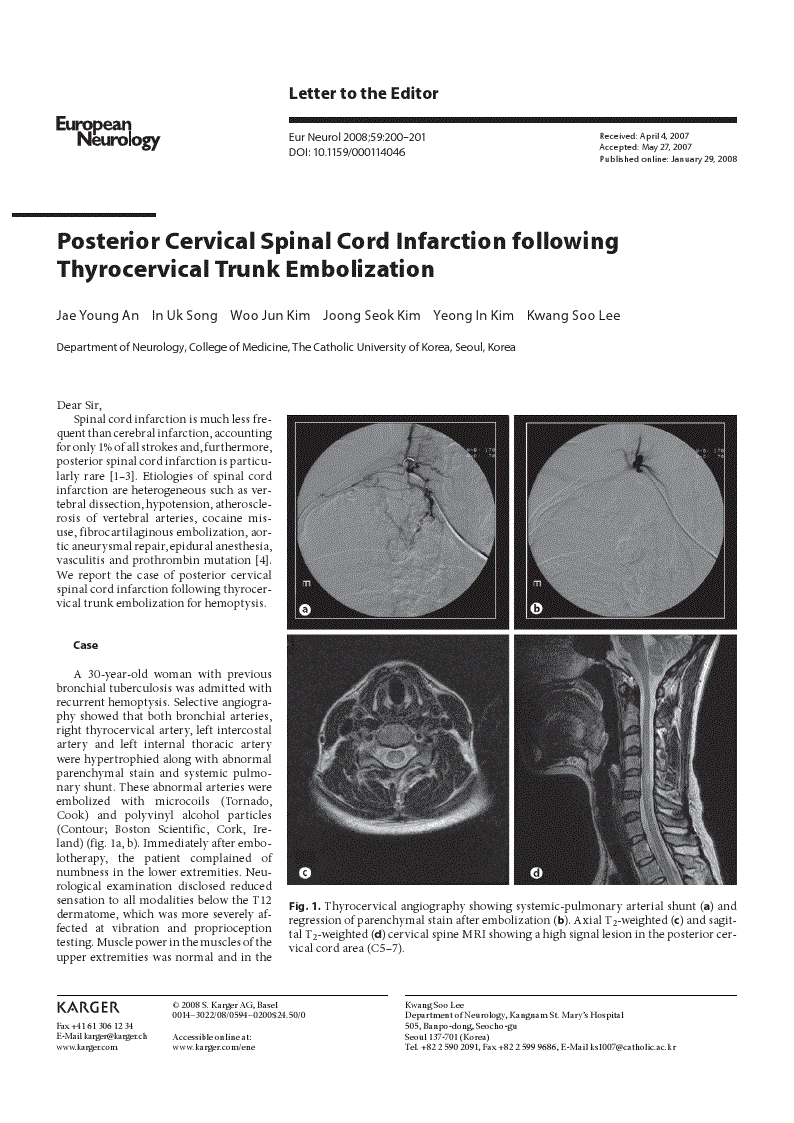 Posterior Cervical Spinal Cord Infarction following Thyrocervical Trunk ...