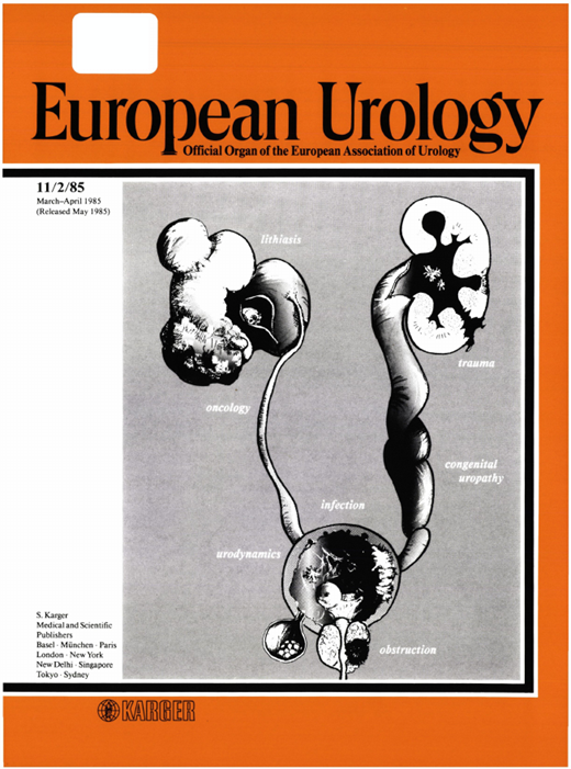 Transitional Cell Carcinoma of the Prostate | European Urology | Karger ...