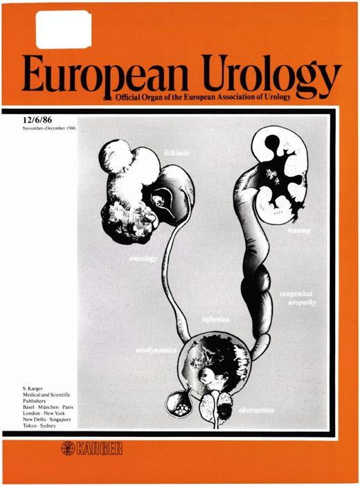 Primary Melanoma in the Female Distal Urethra | European Urology ...