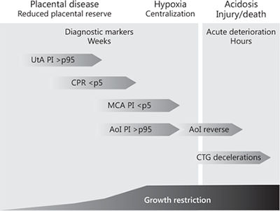 Update on the Diagnosis and Classification of Fetal Growth Restriction ...