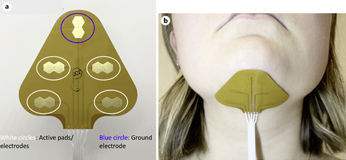 Advances for Dysphagia in the Digital Age: Integrative Imaging and ...