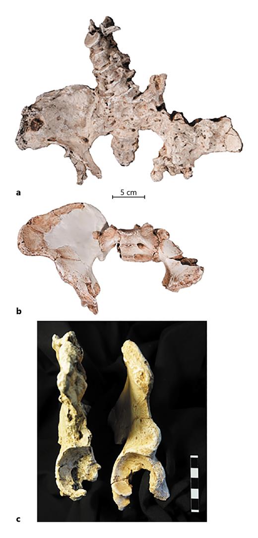 StW 573 Australopithecus prometheus: Its Significance for an ...