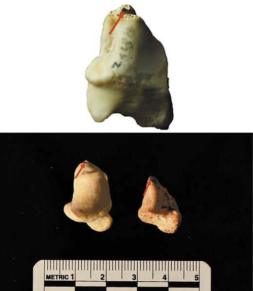 StW 573 Australopithecus prometheus: Its Significance for an ...